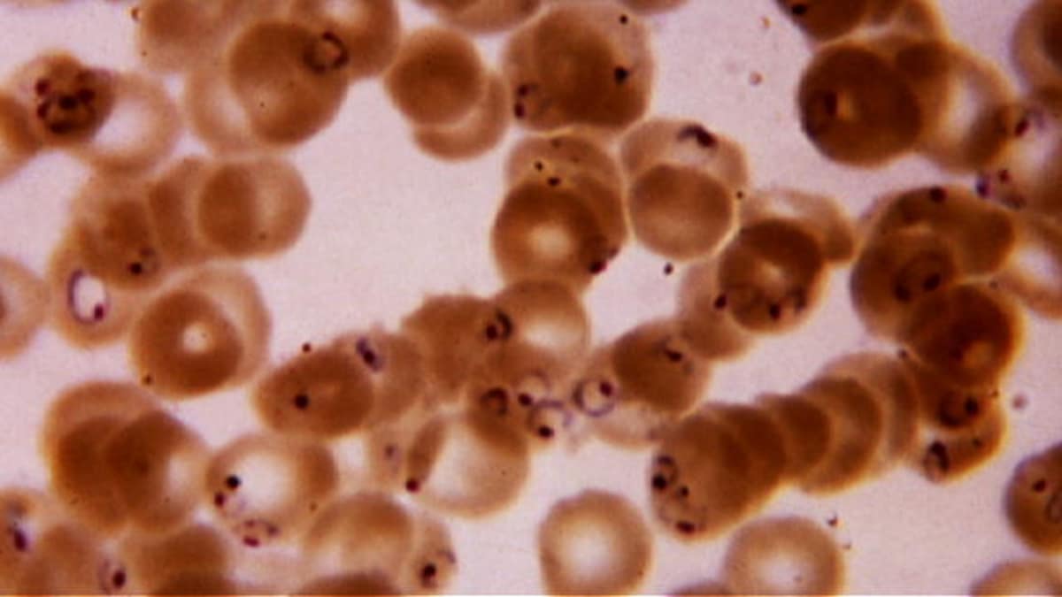 The Deadliest Parasitic Disease - Monsters Inside Me | Animal Planet