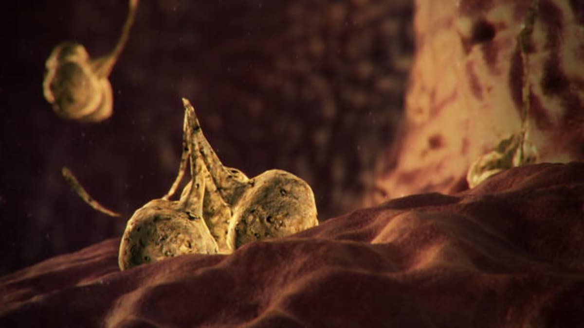 Fungus in the Lungs - Monsters Inside Me | Animal Planet