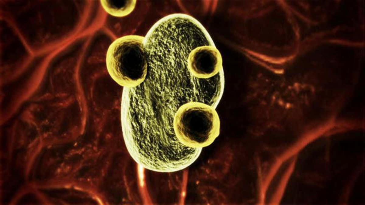 The Tick-Borne Parasite - Monsters Inside Me | Animal Planet