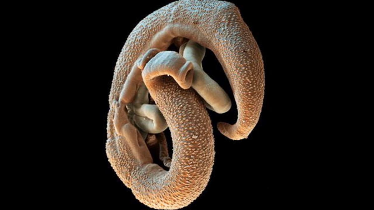 The "Snail Fever" Parasite - Monsters Inside Me | Animal Planet