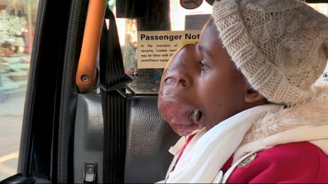 Four Sisters Suffer from the Same Debilitating Bone Disorder - Body ...