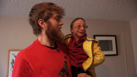 Four Sisters Suffer from the Same Debilitating Bone Disorder - Body ...