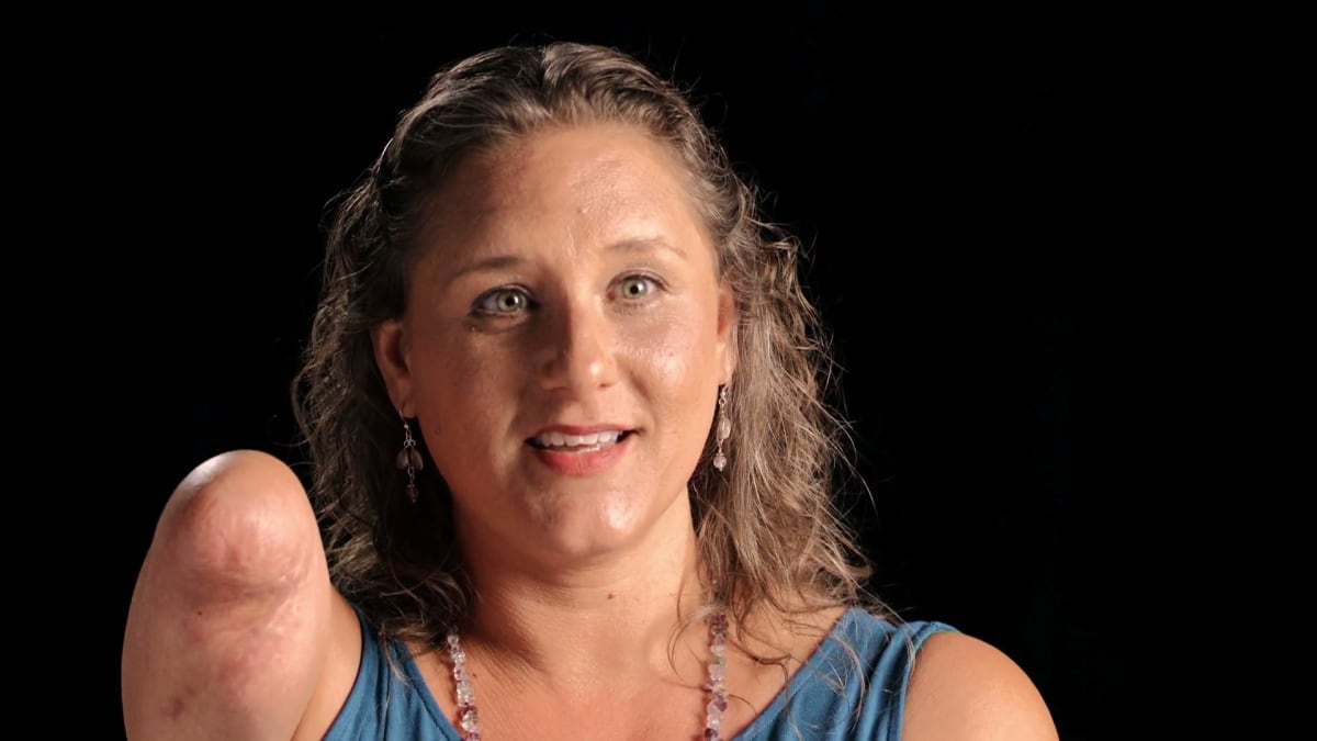 Alligator Tears off Swimmer's Arm - I Was Prey | Animal Planet