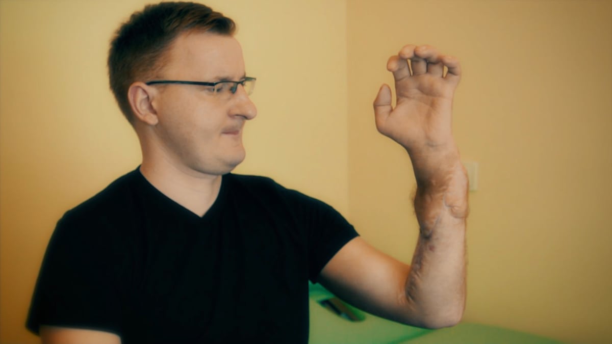 The Tallest Boy and the Man with his First Hand - Body Bizarre ...