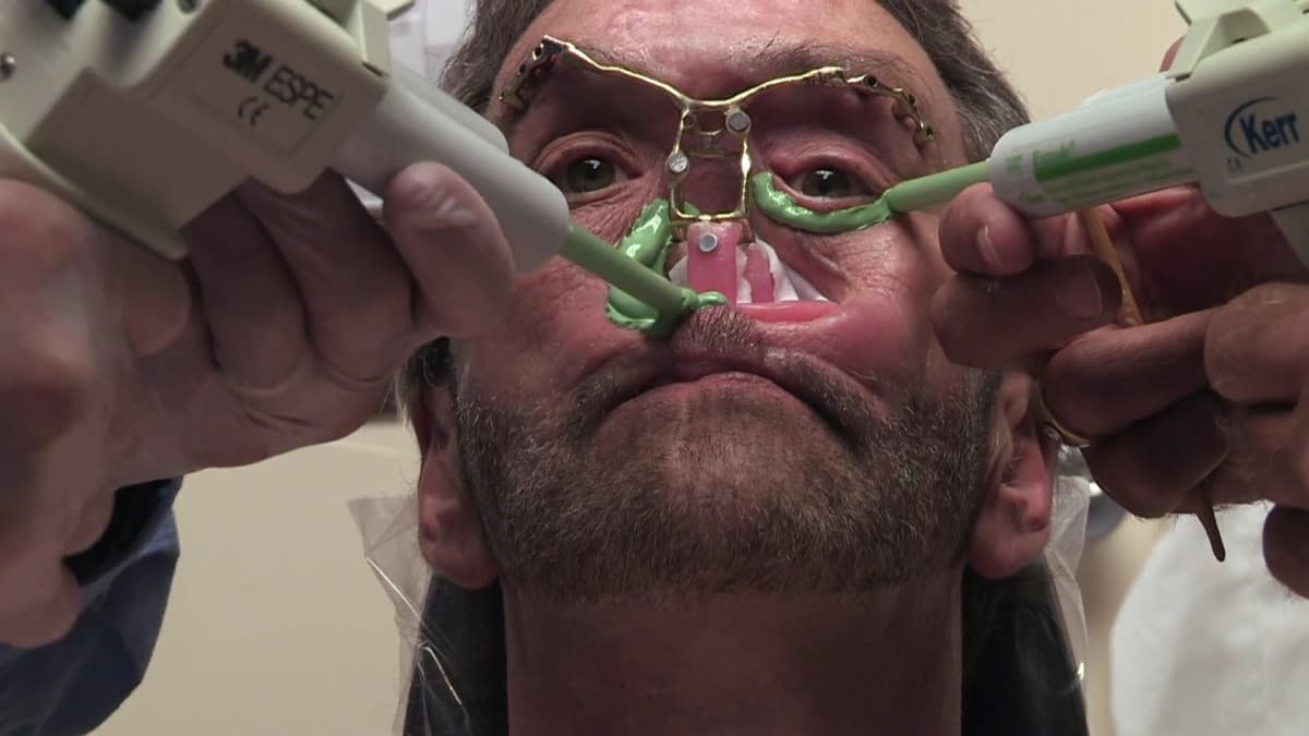 My Baby's Got an Extra Head | Body Bizarre